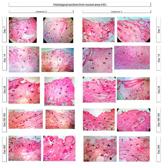 Comparison of Absorbable and Nonabsorbable Sutures for Intradermal Skin ...
