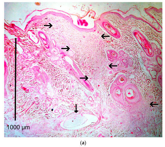 Comparison of Absorbable and Nonabsorbable Sutures for Intradermal Skin ...
