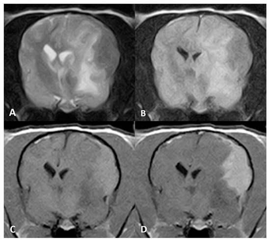 Intracranial Granular Cell Tumours in Three Dogs: Atypical Magnetic ...