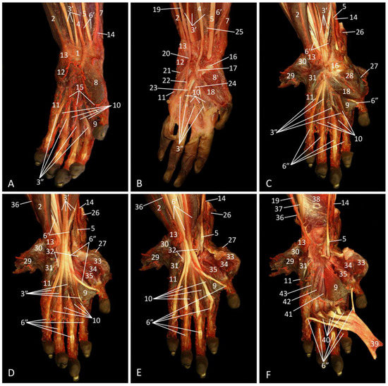 Topographical Anatomy of the Rhesus Monkey (Macaca mulatta)—Part I ...