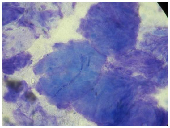 Comparison of Adhesive Tape Impression Cytology, Hair Plucks, and ...