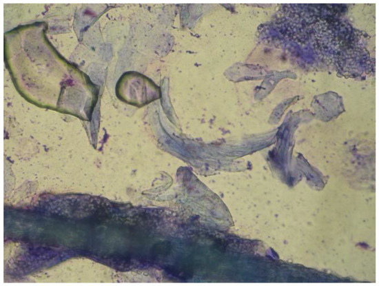 Comparison of Adhesive Tape Impression Cytology, Hair Plucks, and ...