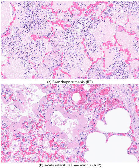 Determining Frequency of Common Pulmonary Gross and Histopathological ...