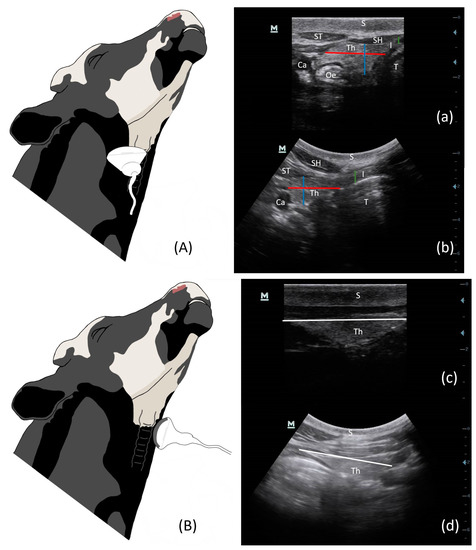 Technical Validation of Ultrasound Assessment of the Thyroid Gland in ...