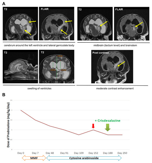 Off-Label Use of Crisdesalazine (GedaCure) in Meningoencephalitis in ...