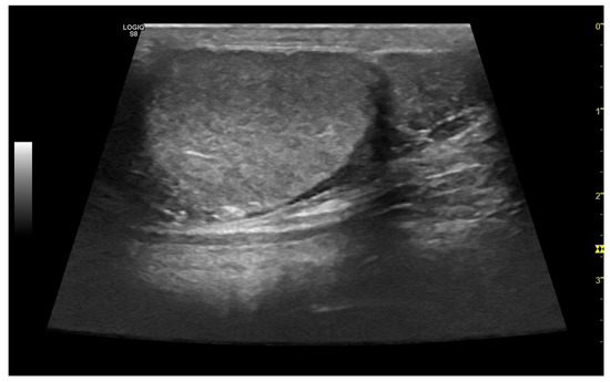Ultrasound-Based Technologies for the Evaluation of Testicles in the ...