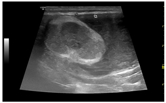 Ultrasound-Based Technologies for the Evaluation of Testicles in the ...
