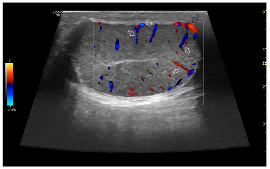 Ultrasound-Based Technologies for the Evaluation of Testicles in the ...
