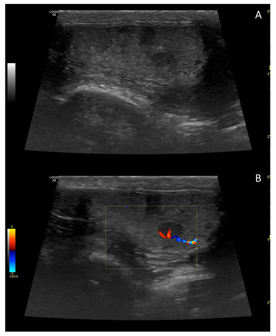 Ultrasound-Based Technologies for the Evaluation of Testicles in the ...