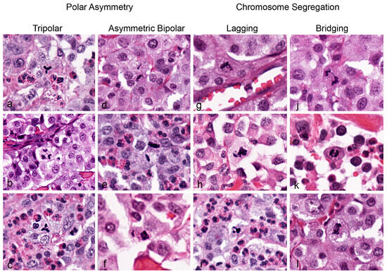 Atypical Mitotic Figures Are Prognostically Meaningful for Canine ...