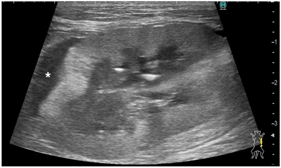 Ultrasonographic Renal Subcapsular Thickening in Cats with Primary and ...
