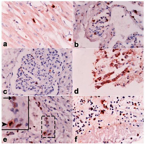 Characterizations of Elephant Endotheliotropic Herpesvirus Type 1A and ...
