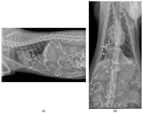 True Diaphragmatic Hernia (Morgagni Hernia) Incidentally Diagnosed with ...