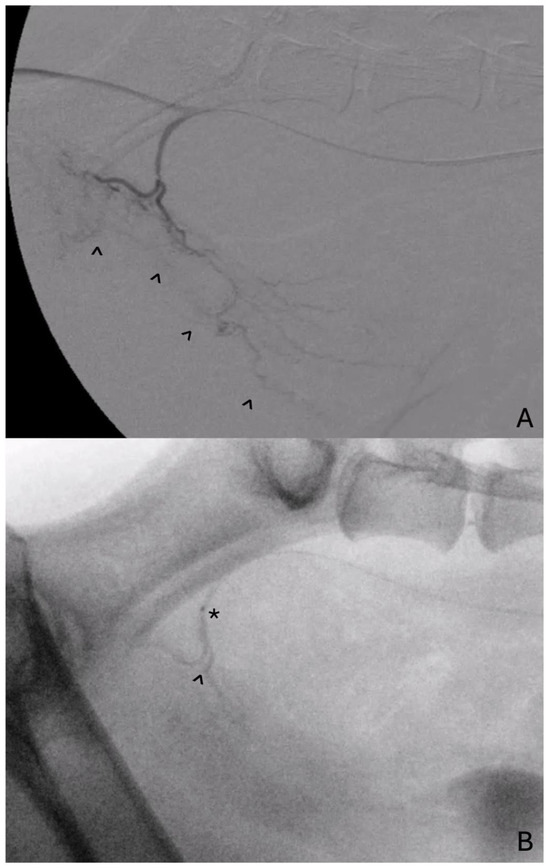 Canine Prostate Cancer: Current Treatments and the Role of ...