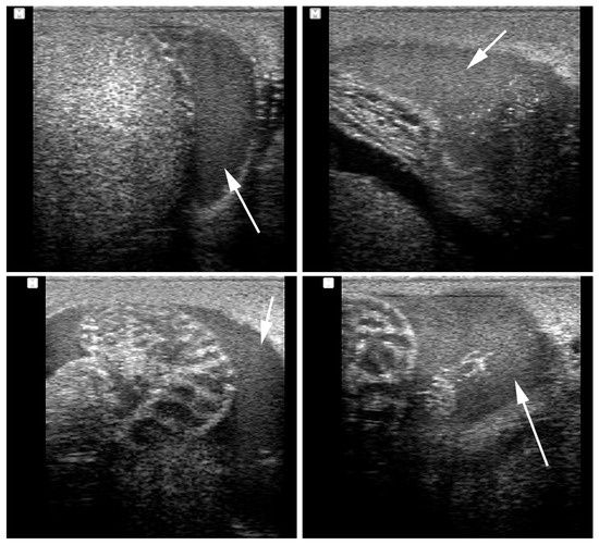 Diagnostic Approach to Equine Testicular Disorders