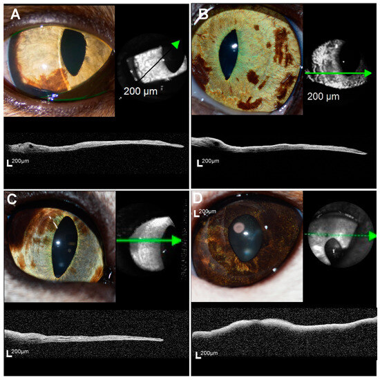 A Pilot Study to Evaluate the Usefulness of Optical Coherence Tomography for Staging Iris ...