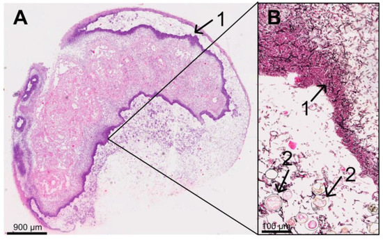 Chalkbrood Disease Caused by Ascosphaera apis in Honey Bees (Apis ...