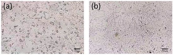 The Latest Prevalence, Isolation, and Molecular Characteristics of ...