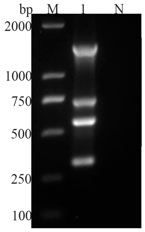 A Multiplex PCR Assay for Simultaneous Detection of Giardia duodenalis ...