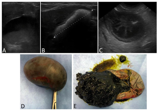 Nutritional Factors Related to Canine Gallbladder Diseases—A Scoping Review