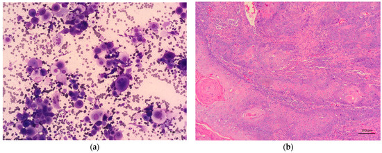 Association Between Cytological and Histopathological Diagnoses of ...