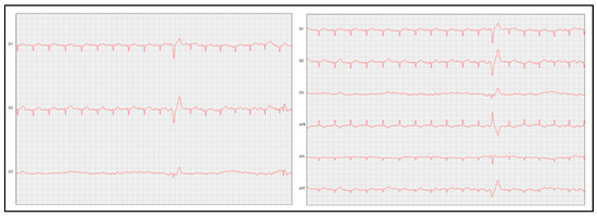 Clinical-Diagnostic and Therapeutic Advances in Feline Hypertrophic ...