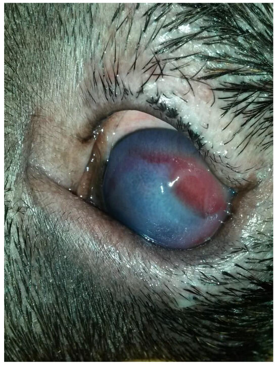 Clinicopathologic Features, Surgical Treatment, and Pathological ...