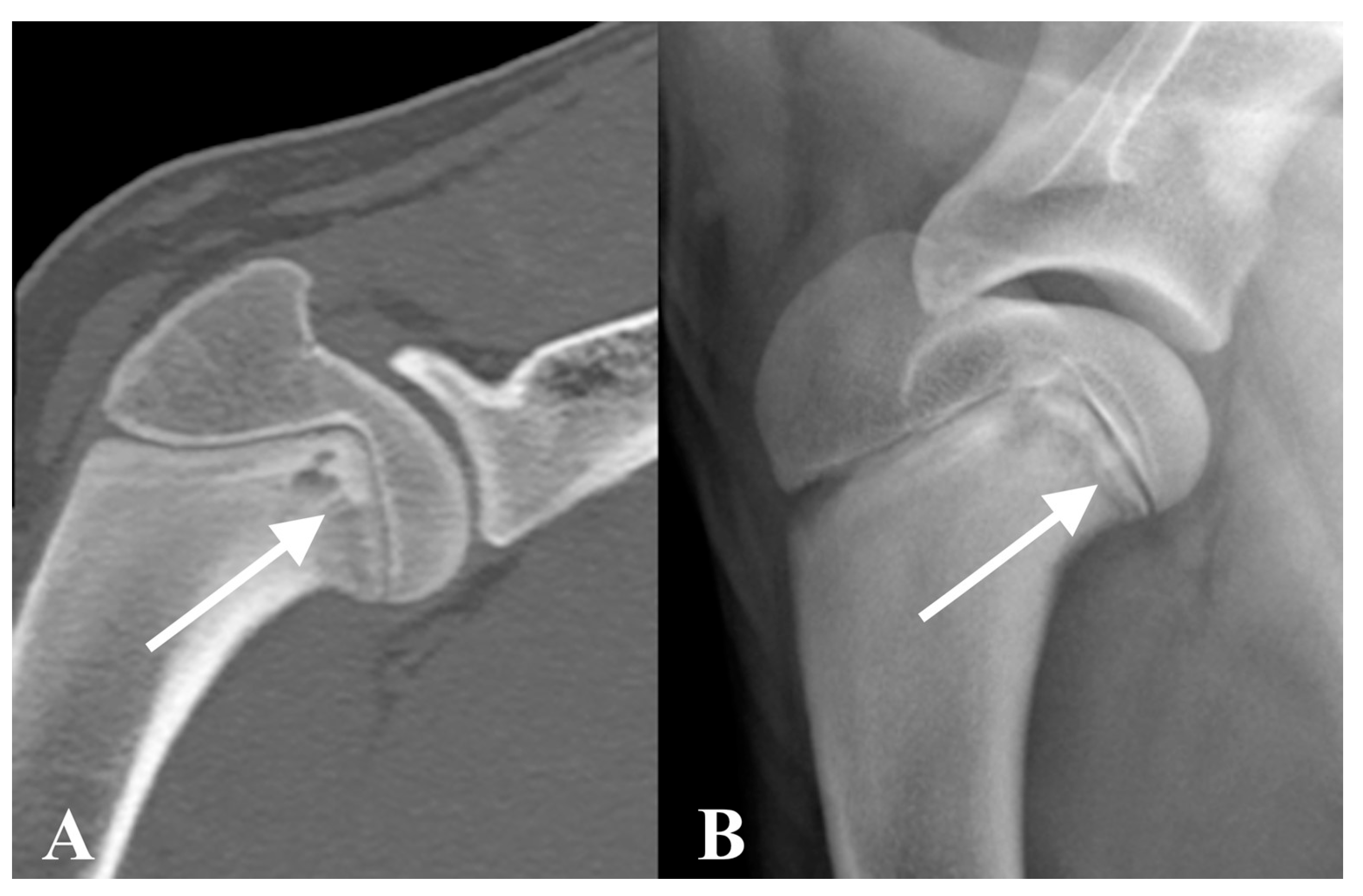 Computed Tomographic Findings in Dogs with Presumed Metaphyseal Osteopathy