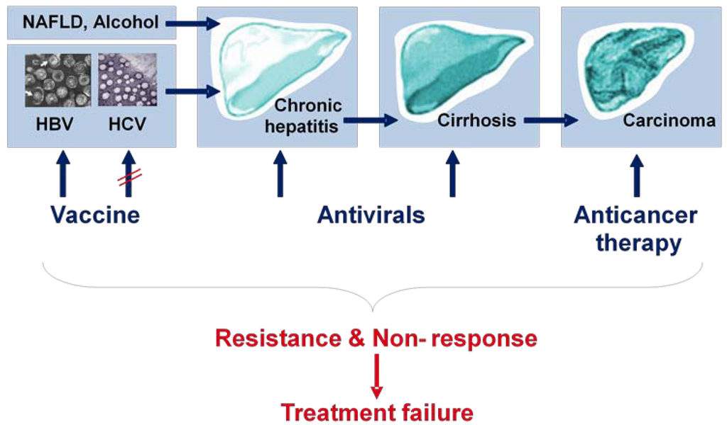 Viruses | Free Full-Text | Hepatitis B and C Viruses and Hepatocellular ...
