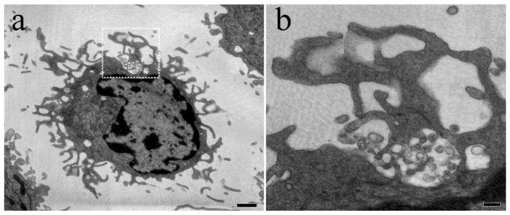 Viruses | Special Issue : Transmission of Retroviruses across ...