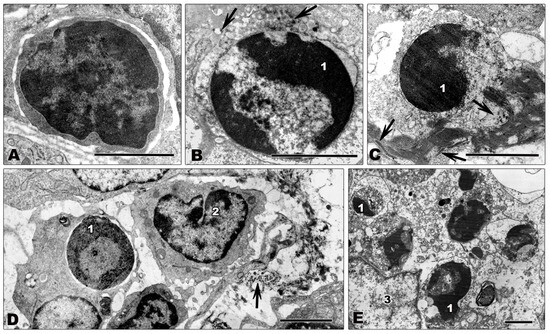 Intracellular Events and Cell Fate in Filovirus Infection