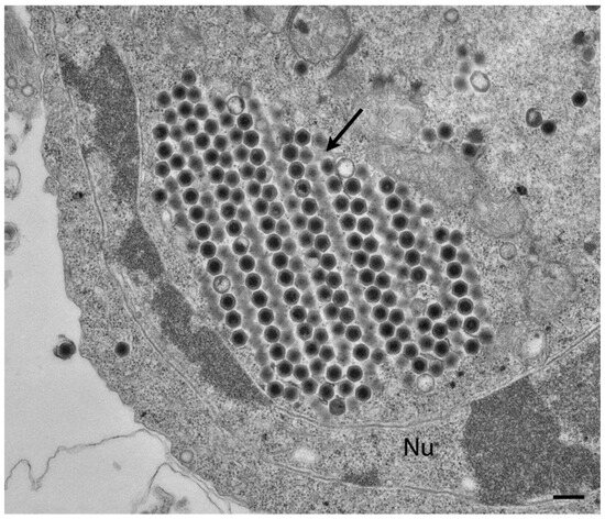 Viruses of Fish: An Overview of Significant Pathogens