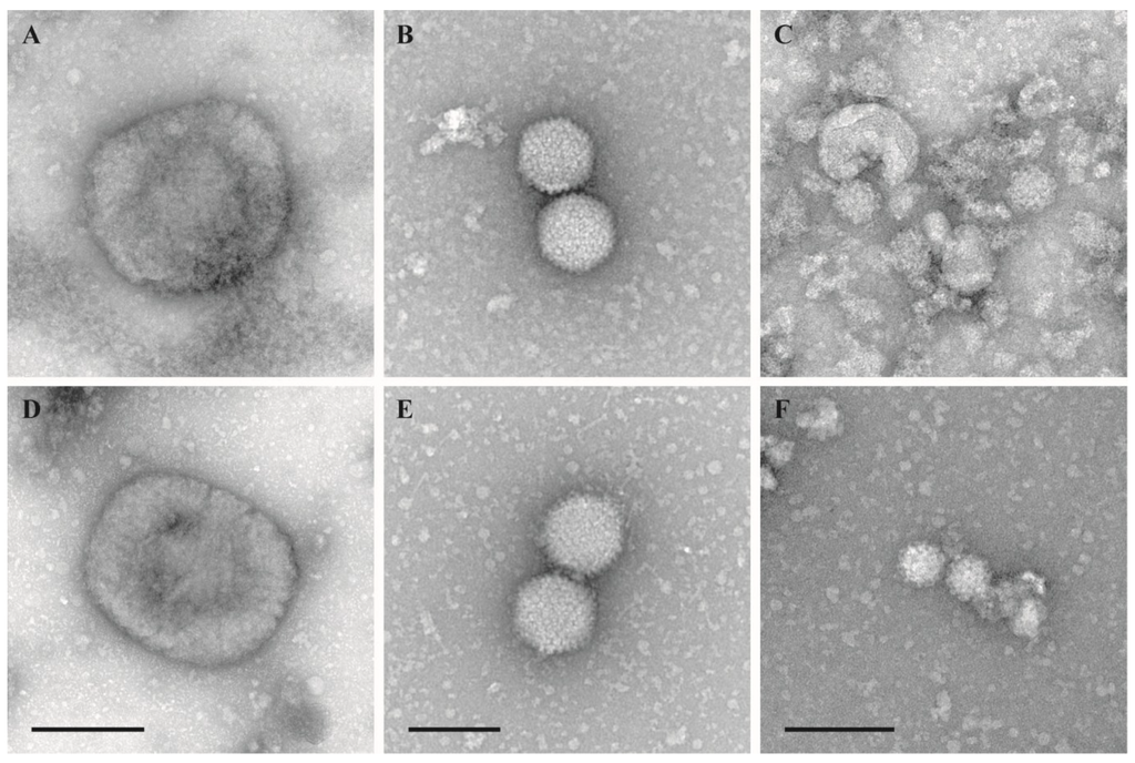 Evaluation of Virus Inactivation by Formaldehyde to Enhance Biosafety ...