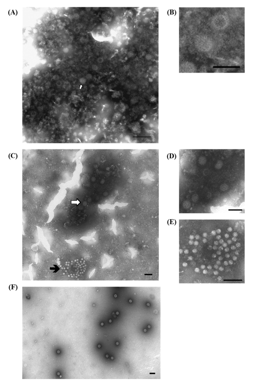 Viruses | Special Issue : Electron Microscopy in Virus Diagnostics and ...