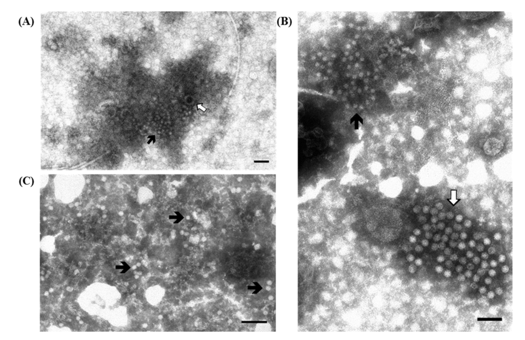 Viruses | Special Issue : Electron Microscopy in Virus Diagnostics and ...