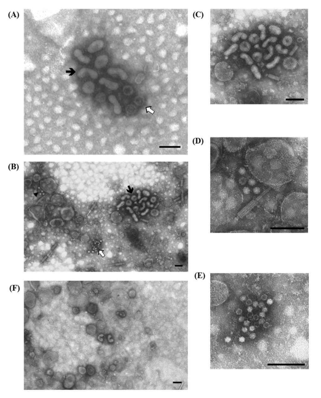 Viruses | Special Issue : Electron Microscopy in Virus Diagnostics and ...