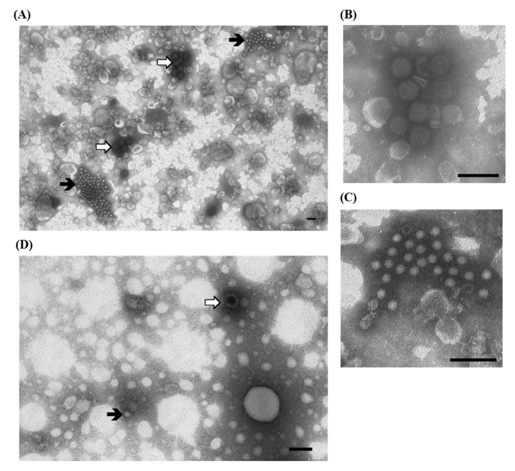 Viruses | Special Issue : Electron Microscopy in Virus Diagnostics and ...
