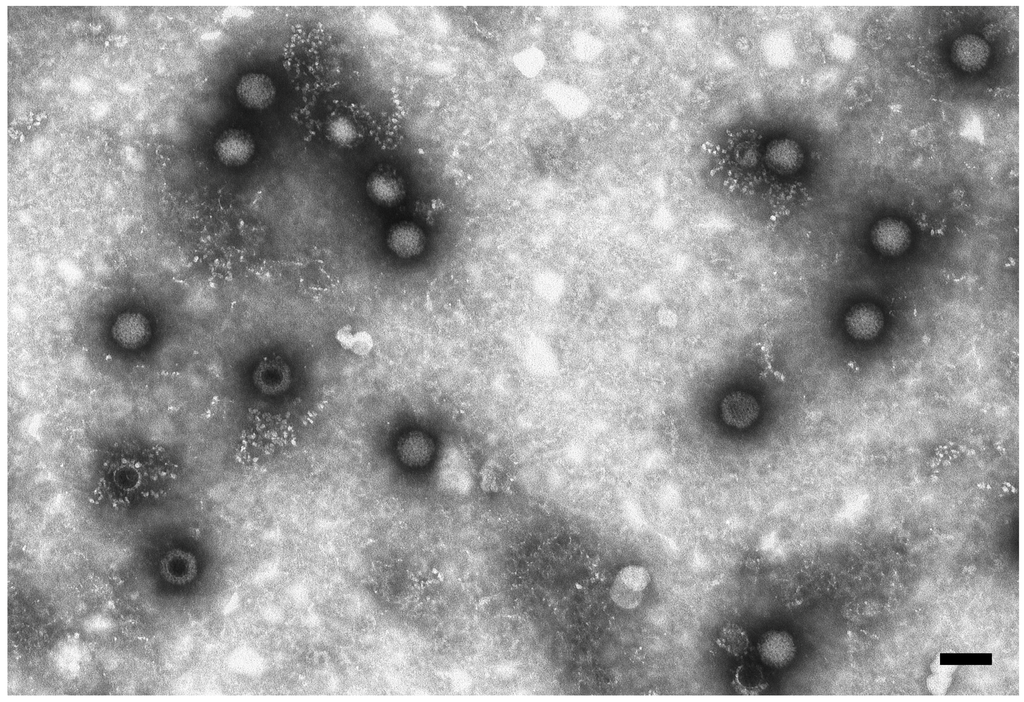 Viruses | Free Full-Text | Detection and Characterization of a Novel ...