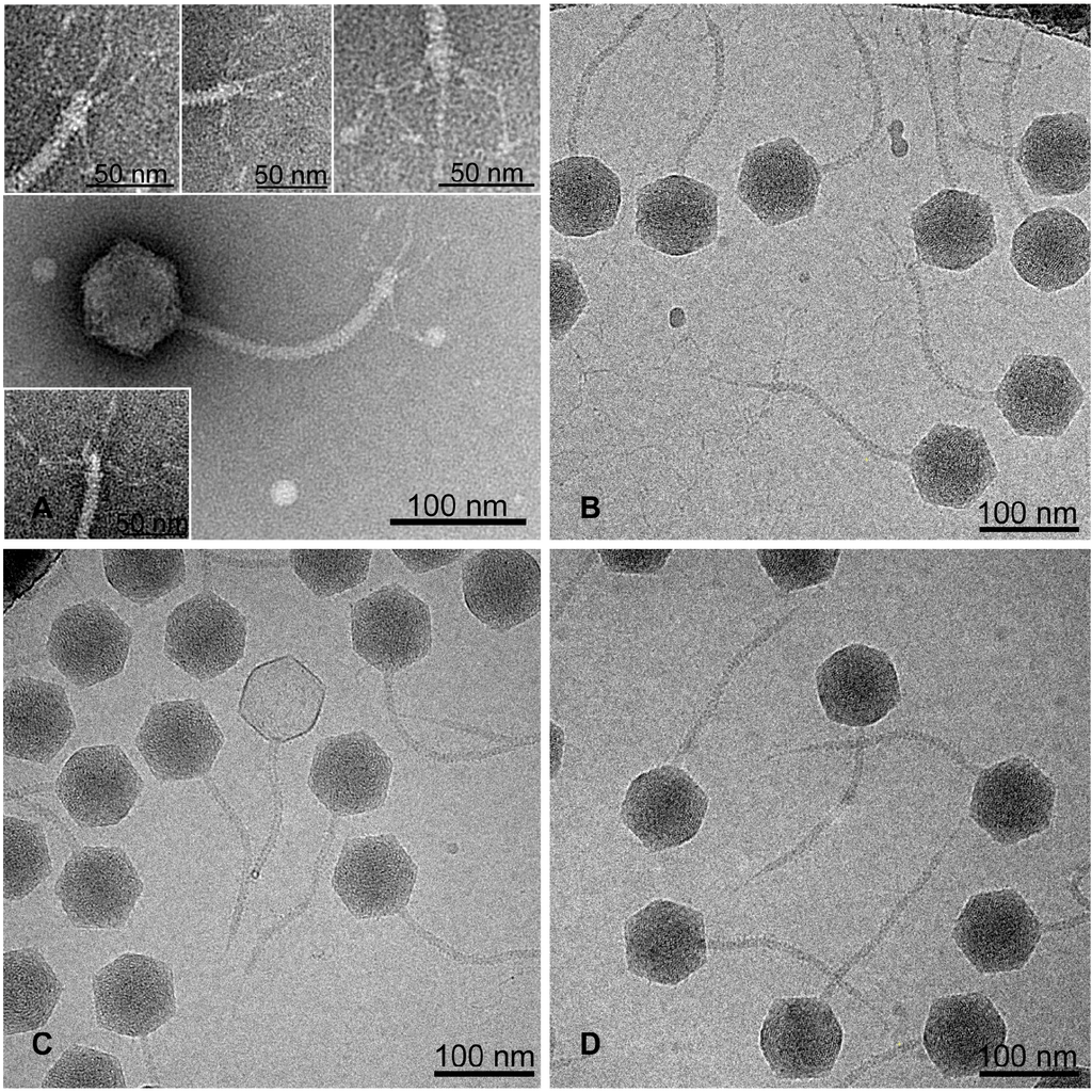 Branched Lateral Tail Fiber Organization in T5-Like Bacteriophages ...