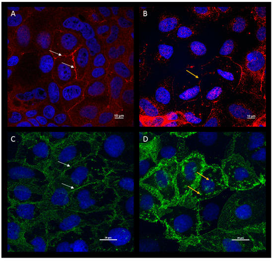 Astrovirus Pathogenesis