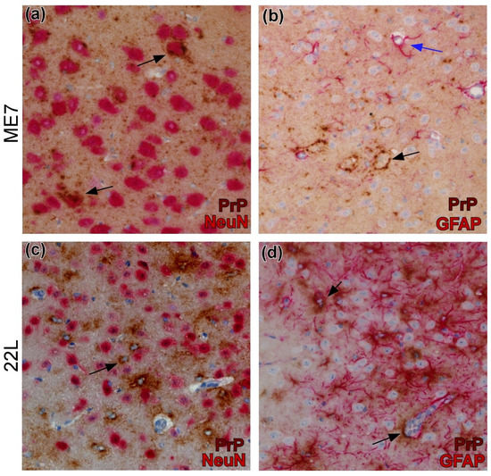 Neuroinflammation, Microglia, and Cell-Association during Prion Disease