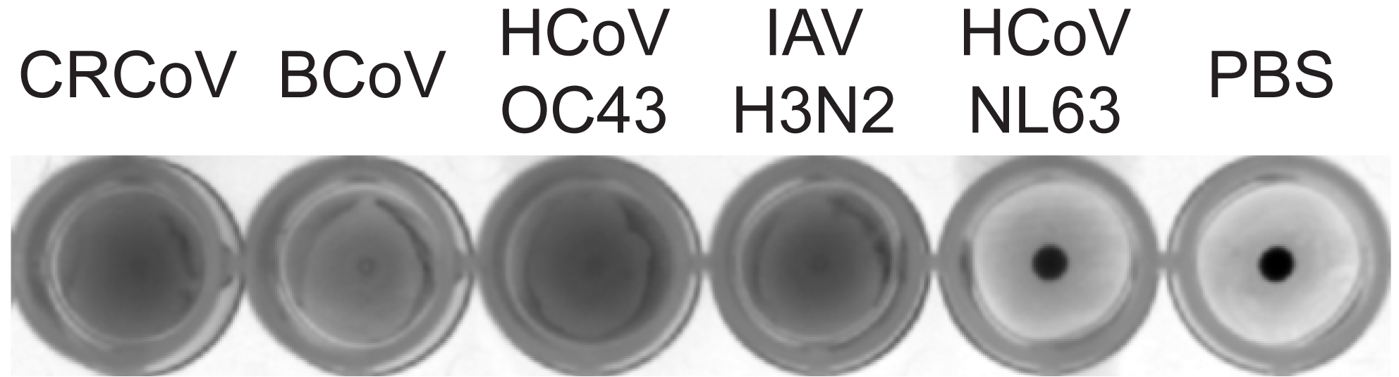 Canine Respiratory Coronavirus, Bovine Coronavirus, and Human ...