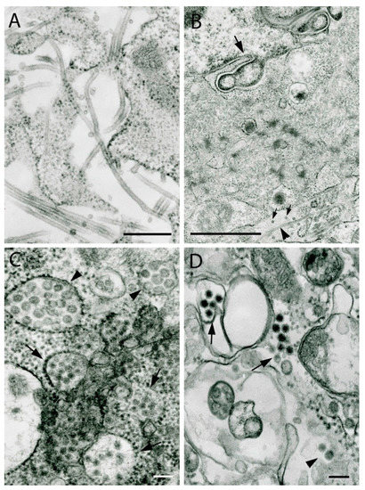 Electron Microscopy in Discovery of Novel and Emerging Viruses from the ...