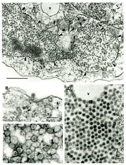 Electron Microscopy in Discovery of Novel and Emerging Viruses from the ...