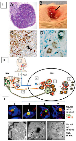 Viruses | Special Issue : Varicella Zoster Virus