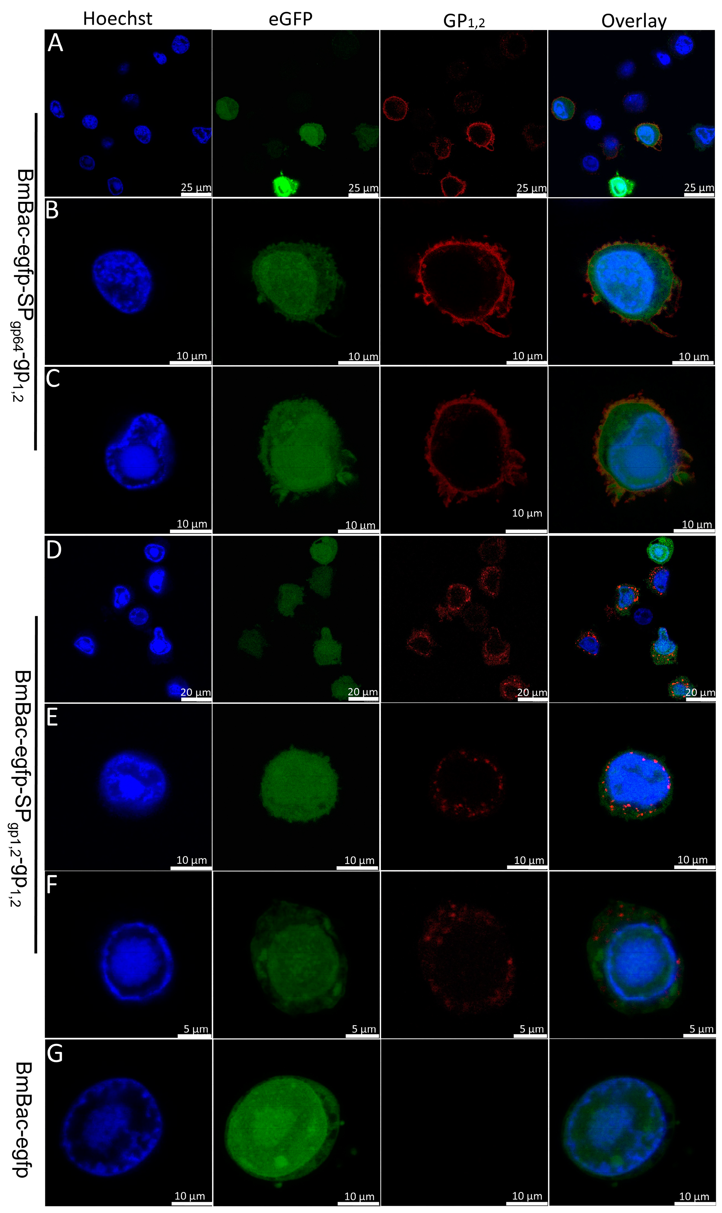 Efficient Expression and Processing of Ebola Virus Glycoprotein Induces ...