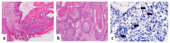 Whole Genomic Analysis and Comparison of Two Canine Papillomavirus Type ...