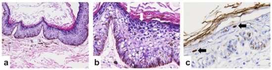Whole Genomic Analysis and Comparison of Two Canine Papillomavirus Type ...