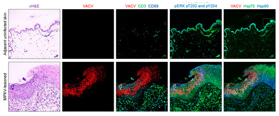 Comparison of Multiplexed Immunofluorescence Imaging to Chromogenic ...