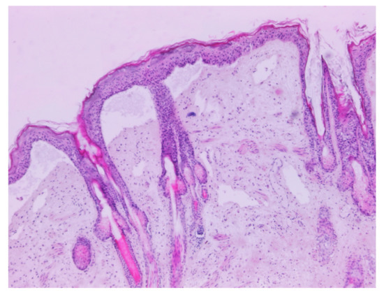 Detection of Recombinant Hare Myxoma Virus in Wild Rabbits (Oryctolagus ...
